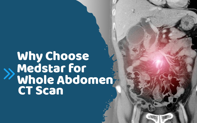 Check Our CT Scan Whole Abdomen Cost in Kolkata - Medstar Clinics