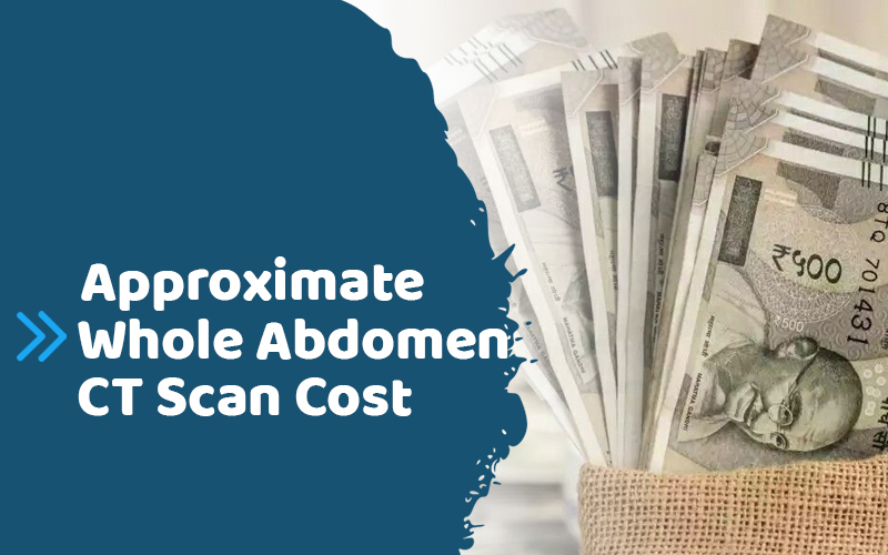 Check Our CT Scan Whole Abdomen Cost in Kolkata - Medstar Clinics